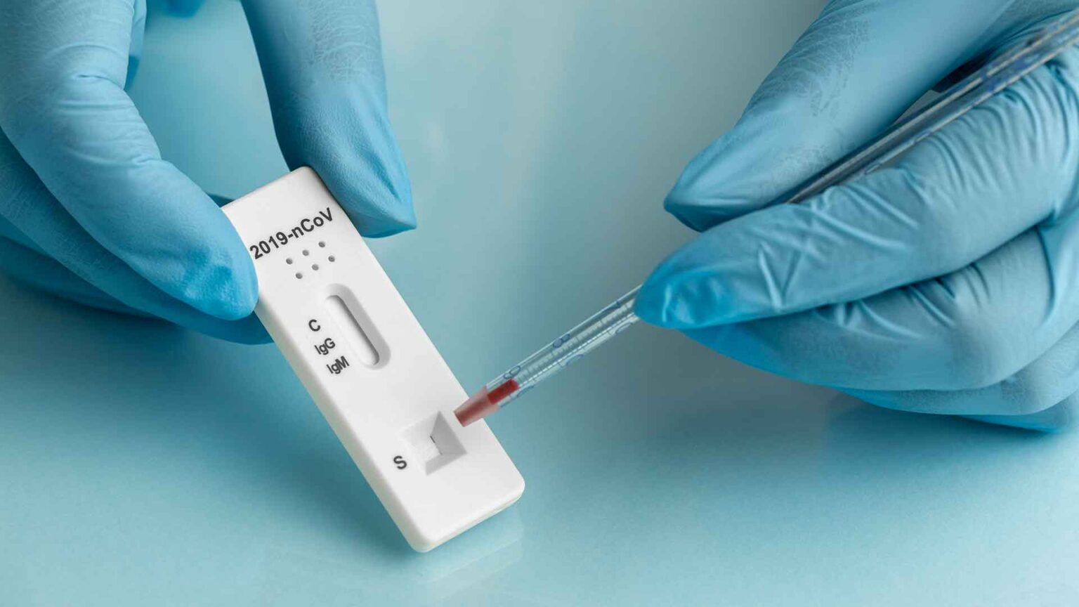 Supervised Fit to fly antigen test - Hove - East Sussex